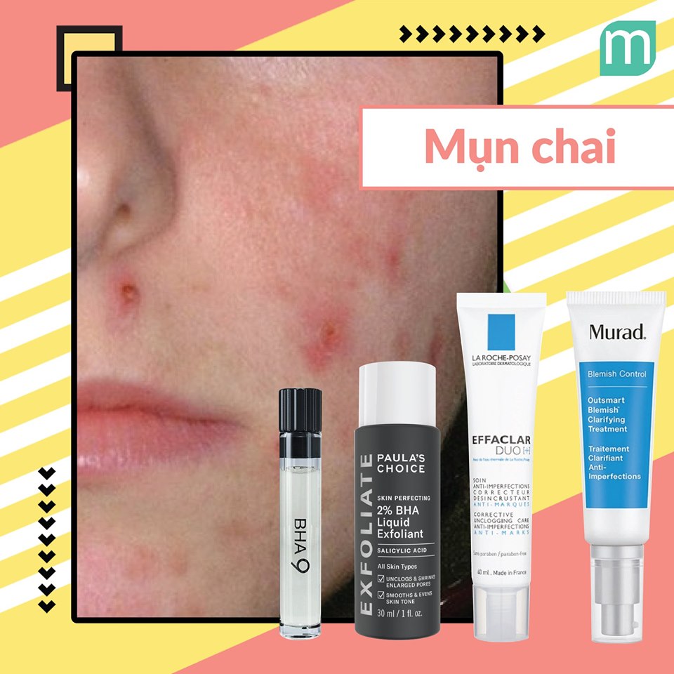 Tổng Hợp Sản Phẩm Trị Mụn Cho Mọi Loại Mụn - Mint Cosmetics - Save The ...