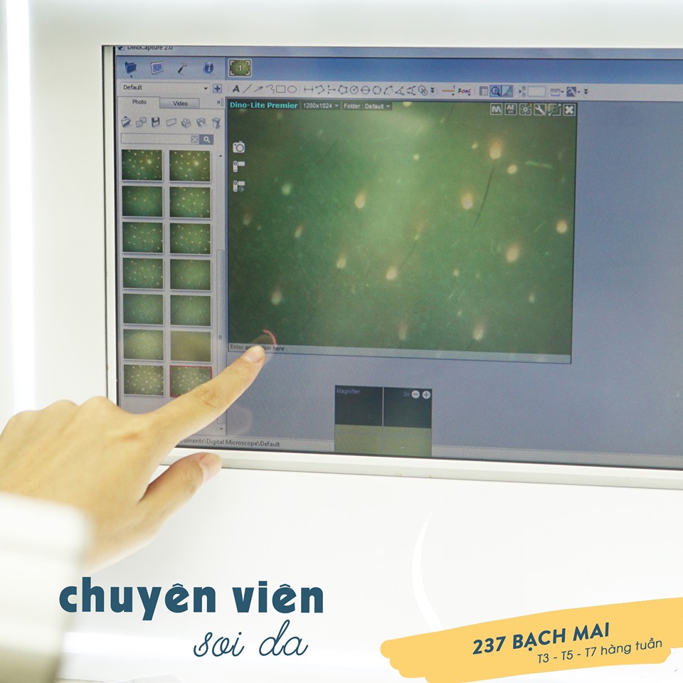 Chương Trình Soi Da Miễn Phí Tại Cơ Sở 237 Bạch Mai - Mint Cosmetics ...