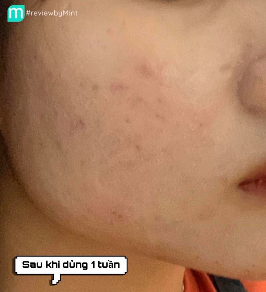 Review Naruko Tea Tree Precious Lotion 2 Lớp - Mint Cosmetics - Save ...