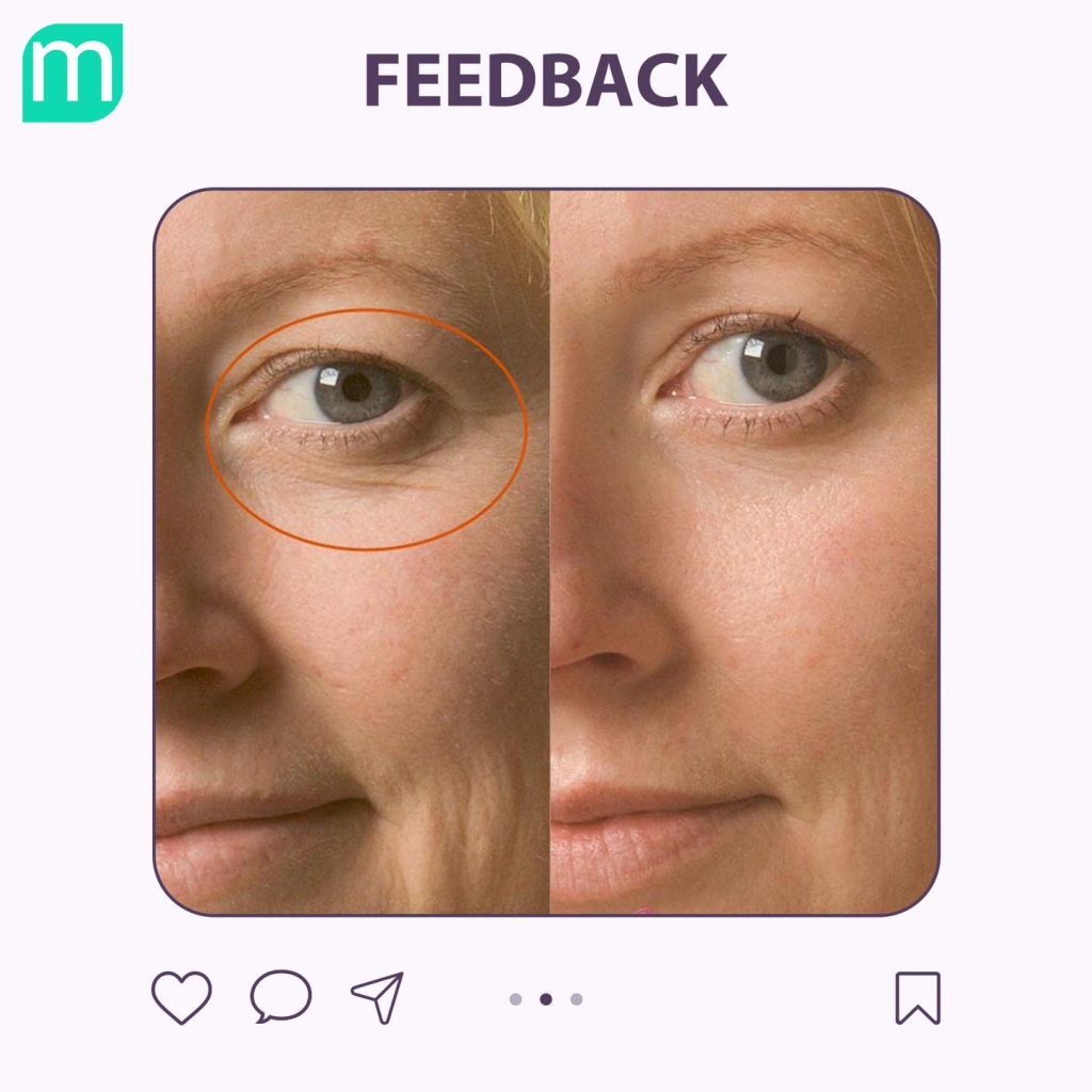 "Tớ Ước Gì Mình Dùng Kem Mắt Sớm Hơn" - Mint Cosmetics - Save The Best ...